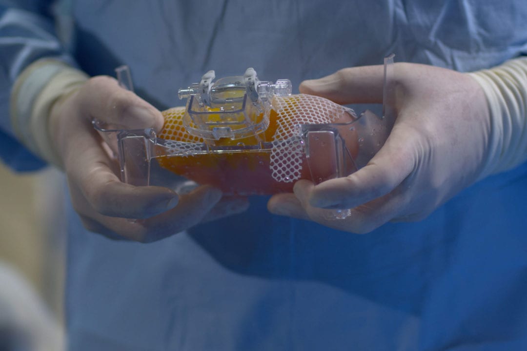 LifePort Kidney Transporter | Organ Recovery Systems