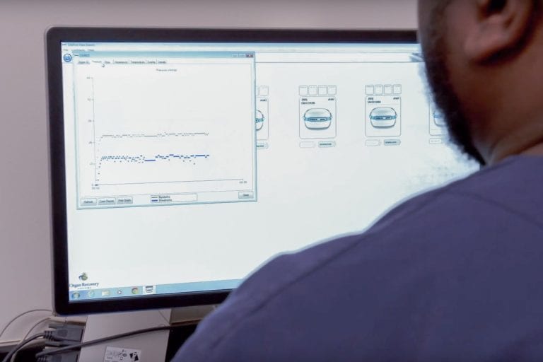 LifePort Kidney Transporter | Organ Recovery Systems