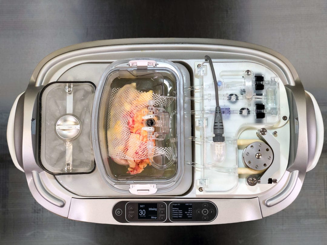 LifePort Kidney Transporter | Organ Recovery Systems