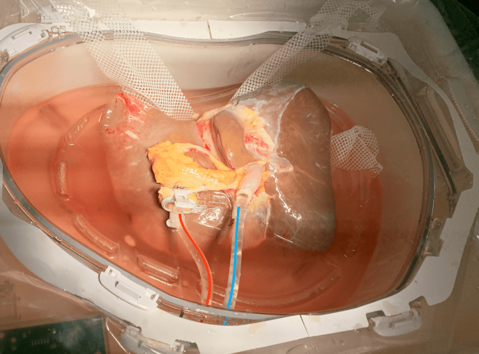 LifePort Liver Transporter | Organ Recovery Systems